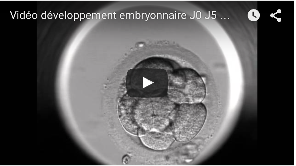 FIV ICSI - Procréalis